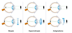 Les différents troubles de la vue - OPH78 Le Port Marly